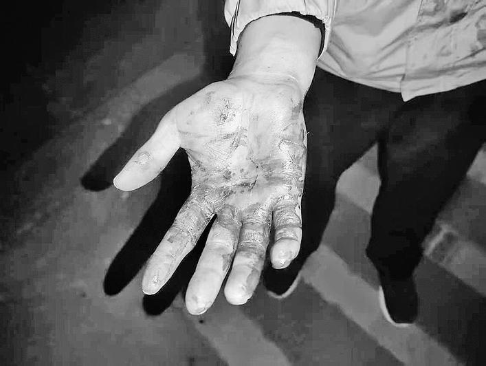 掰开玻璃救出人后，车自燃了