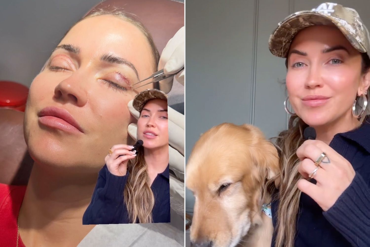Kaitlyn Bristowe Reveals Her Dog Clawed at Her Eye Following Her Upper ...