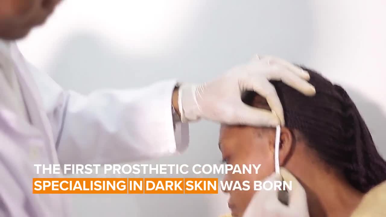 Synthetic body parts for diversity