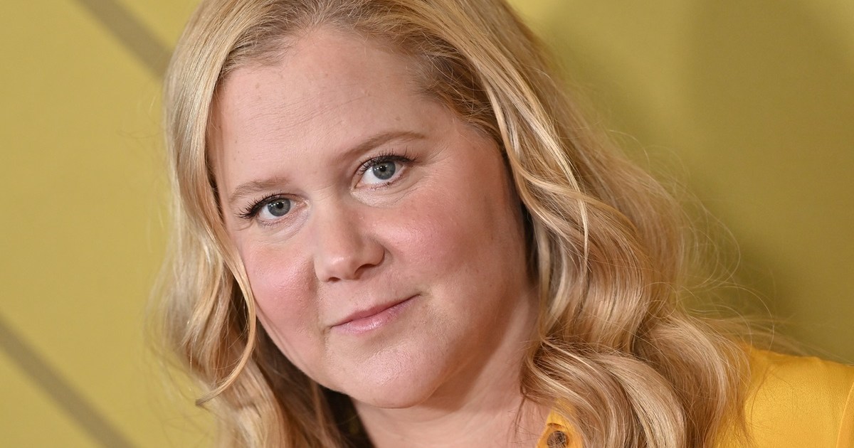 What Is Moon Face? Amy Schumer's Cushing Syndrome Explained