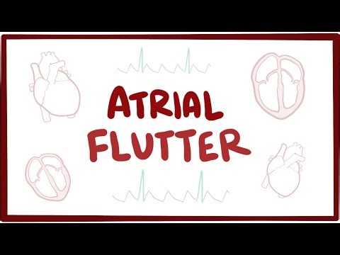 Atrial flutter - causes, symptoms, diagnosis, treatment, pathology