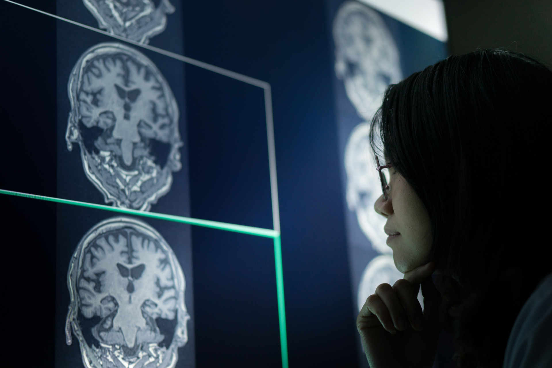 Are you left-brained or right-brained?