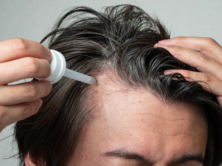 Why you’re not seeing hair growth results with Rogaine — and 3 ways to ...