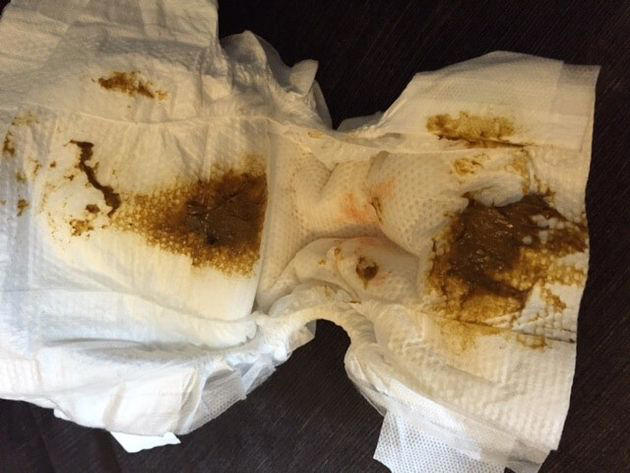 Baby Poo Decoded: These Photos Show What's Normal (And What Really Isn't)