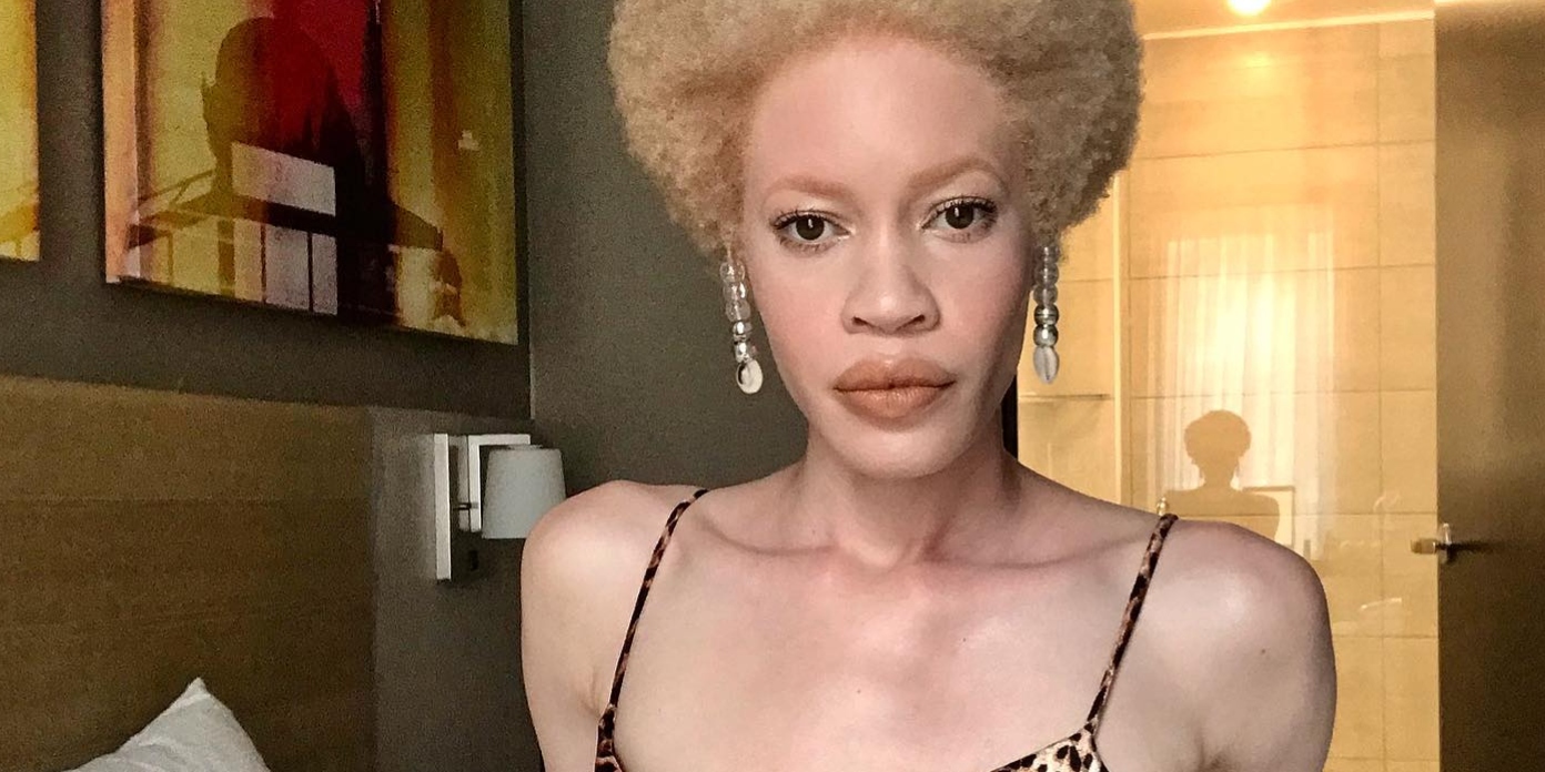 Diandra Forrest, la mannequin albinos de 35 ans qui fascine le monde
