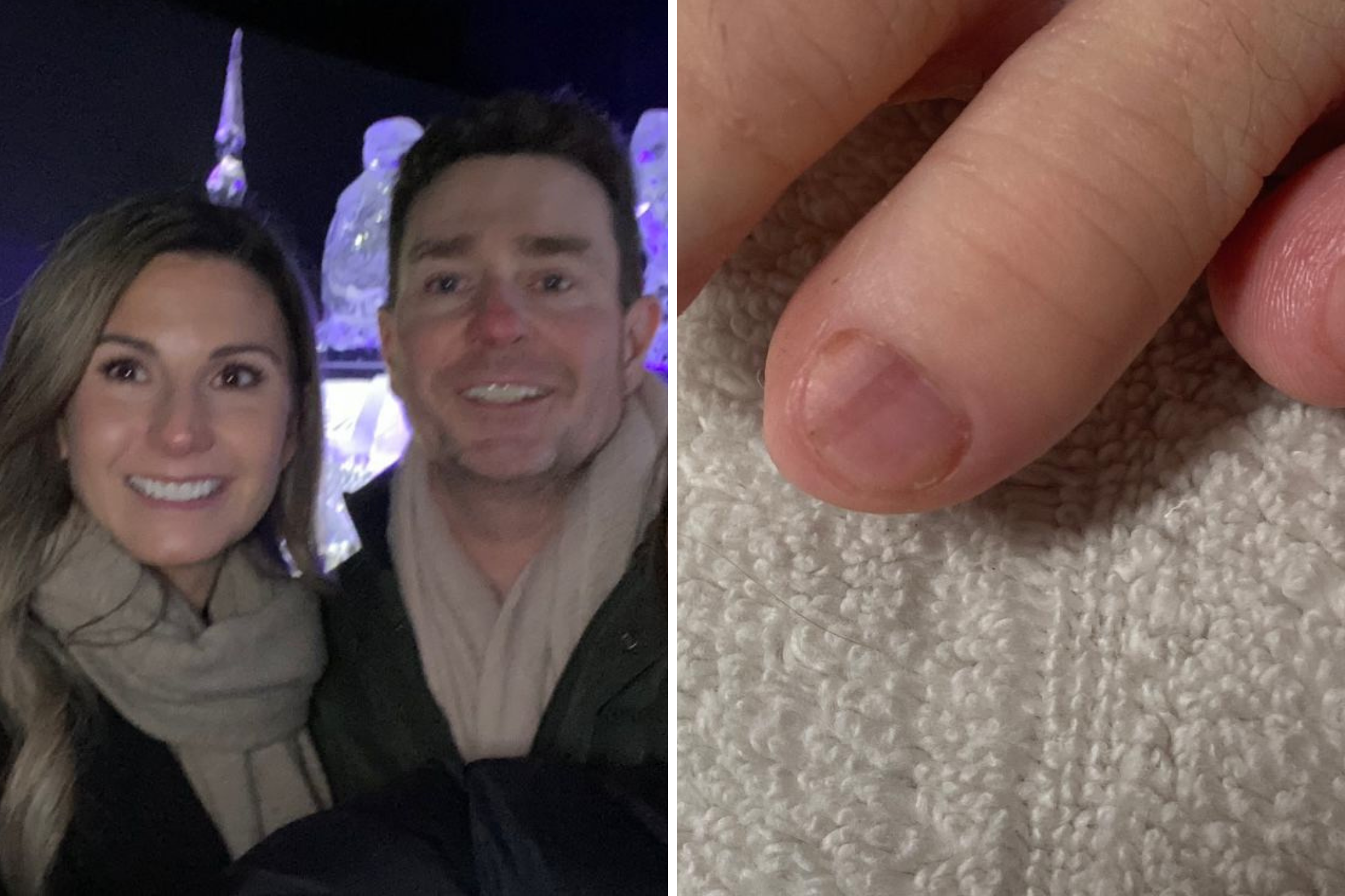 Man Finds Faint Brown Line on Toenail, Turns Out To Be Cancer