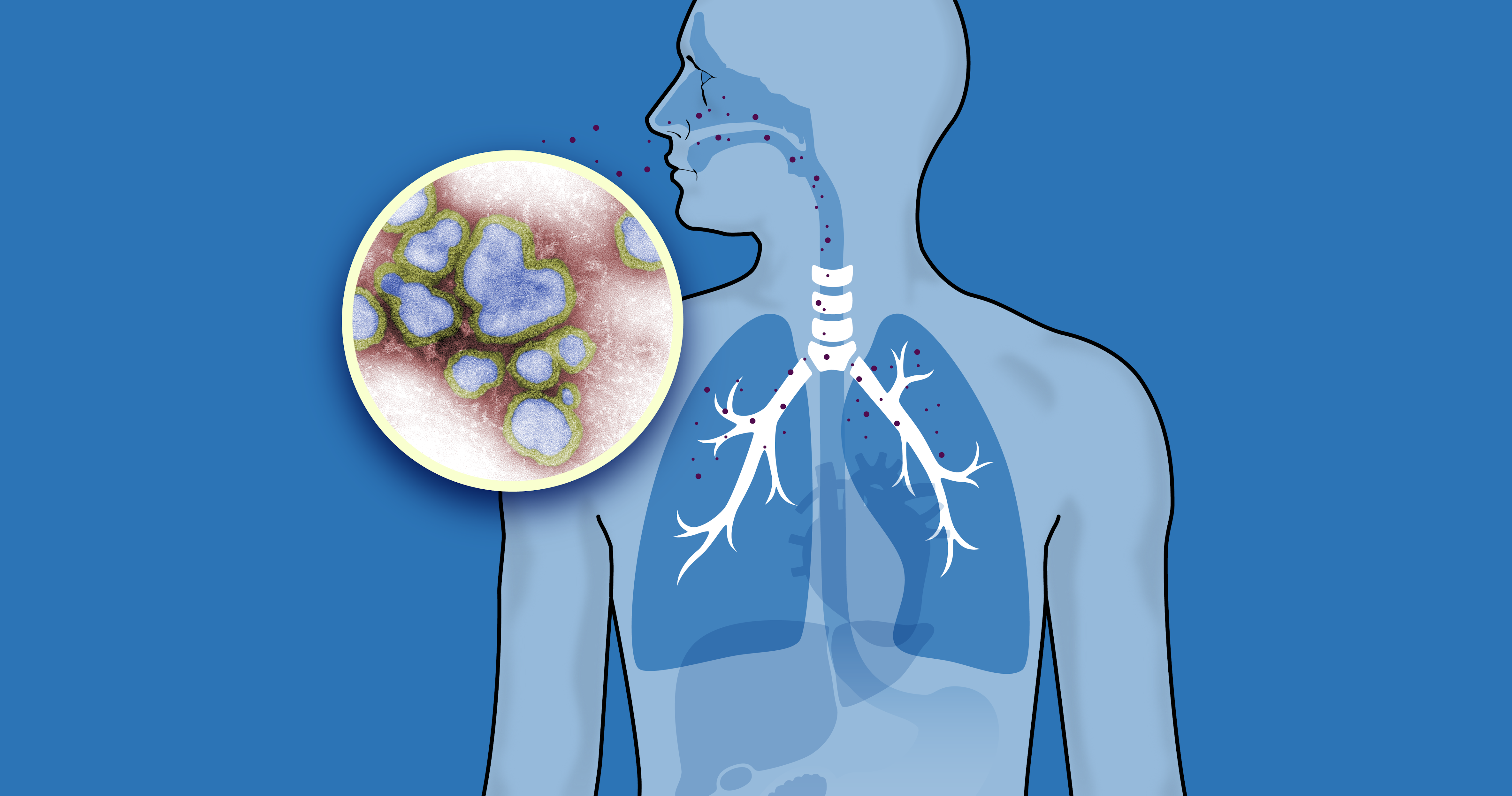 Flu cases spiking in Oklahoma as hospitalizations rise: What to know ...