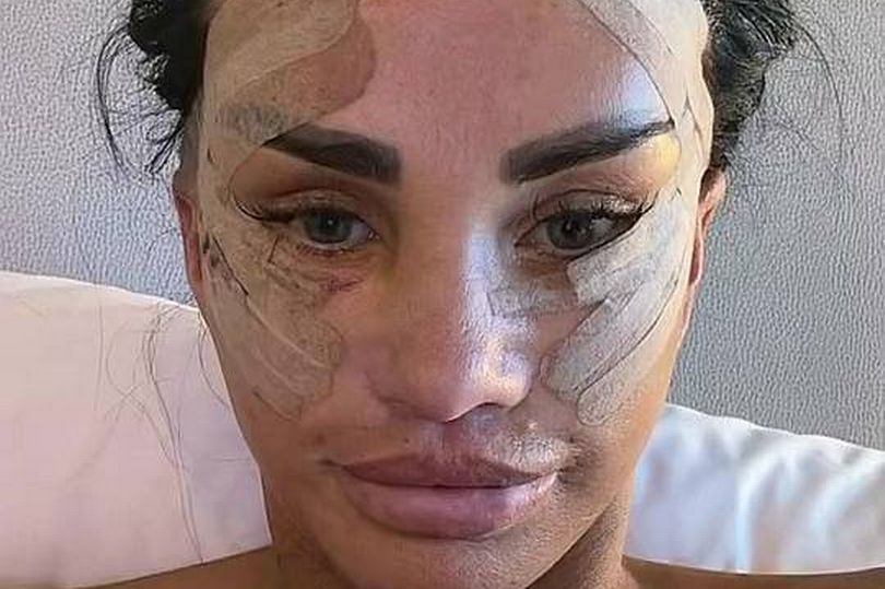 Katie Price shows painful result of latest face lift in bandaged ...