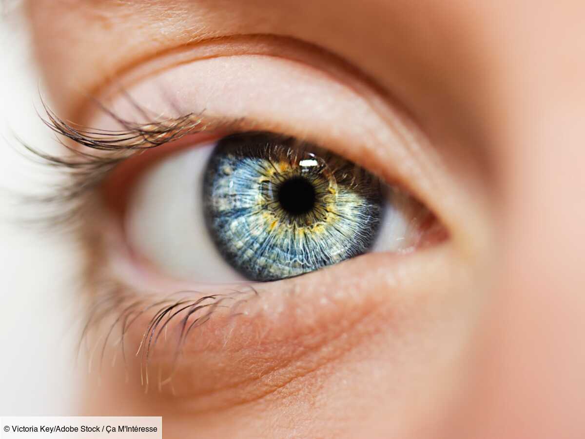 Iridologie : l'iris de vos yeux peut-il vraiment refléter votre état de ...