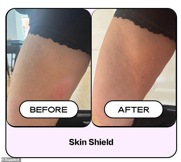 Woman sick of summer chafing reveals exactly how she stopped the pain