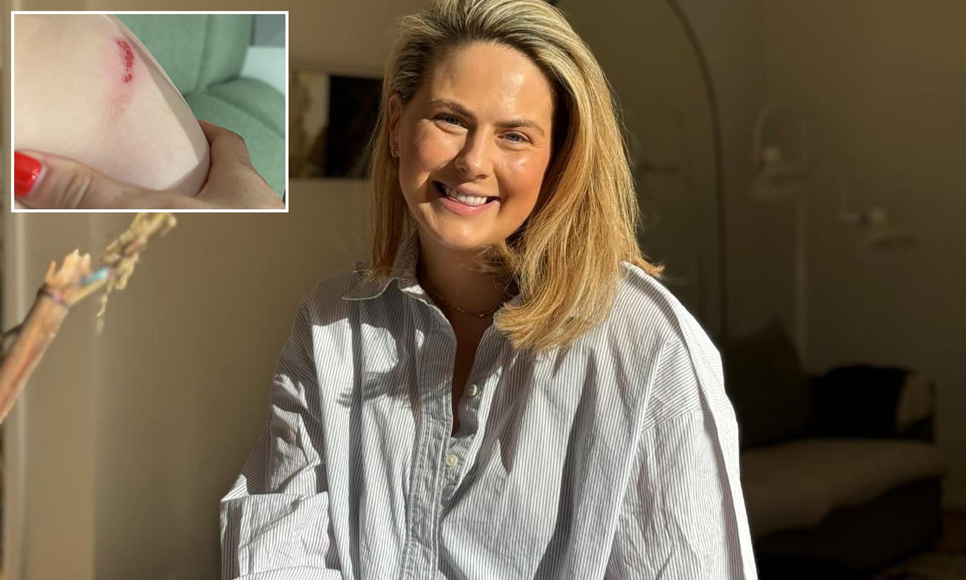 Woman sick of summer chafing reveals exactly how she stopped the pain