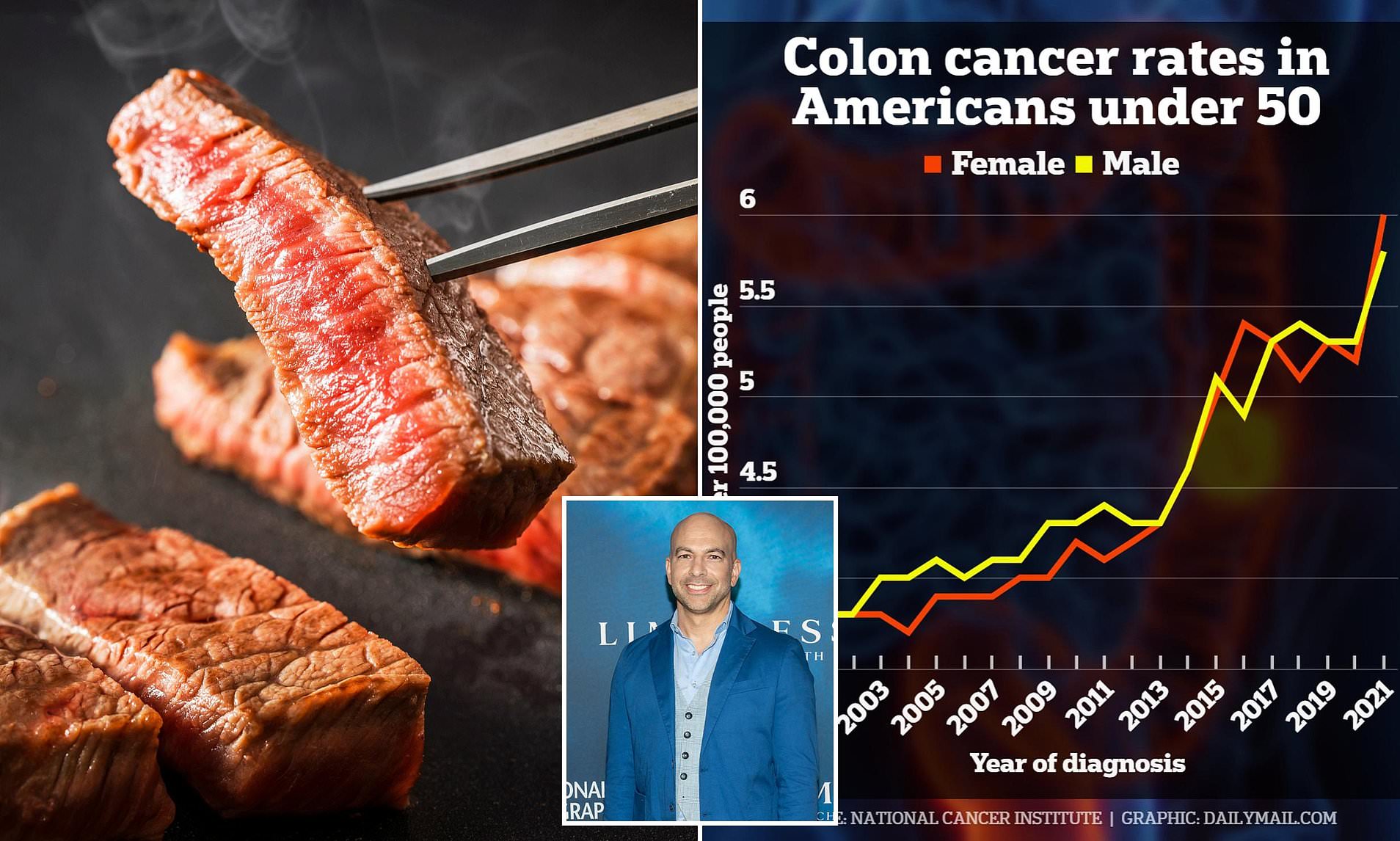 Top doctor exposes whether red meat ACTUALLY causes colon cancer
