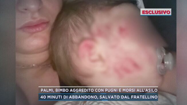Palmi, bimbo aggredito con pugni e morsi all'asilo