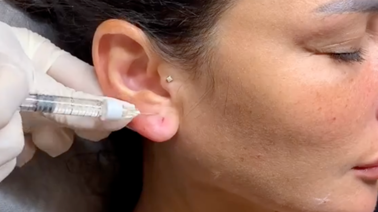 People are getting filler in their ears and the internet says beauty ...