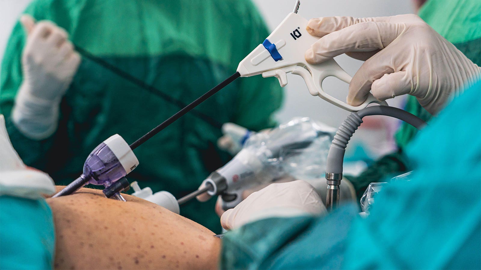 Bariatric Surgery in MASH Patients Improved Long-Term Outcomes