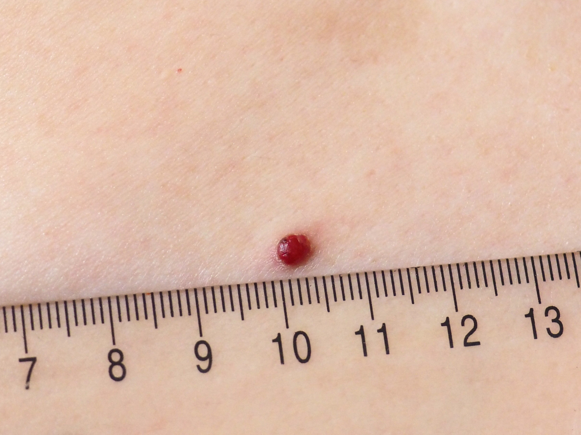 Rare cancers that challenge the medical profession