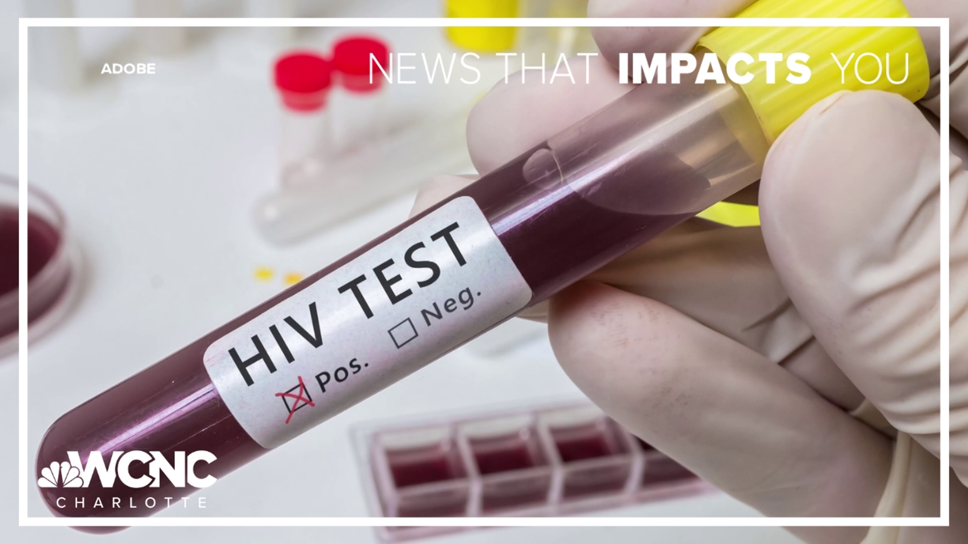 Duke scientists take step towards HIV vaccine