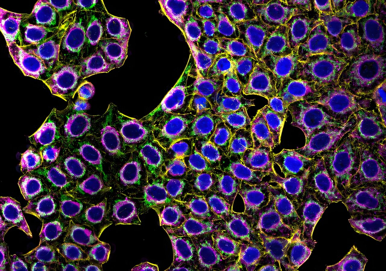 Genome-wide atlas of cell morphology reveals gene functions