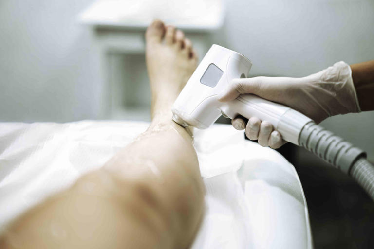 Electrolysis vs. Laser Hair Removal: A Guide to the Hair Removal Techniques