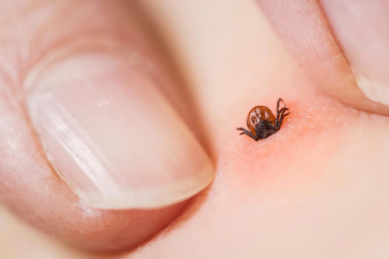What do tick bites look like? Experts reveal exactly how to identify them