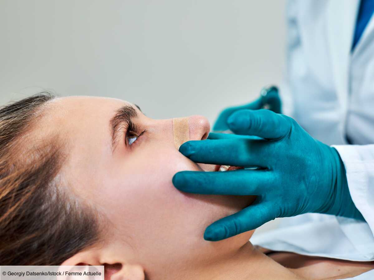 Rhinoplastie ou injections dans le nez : quelles différences et quels ...