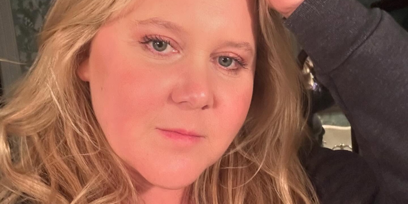 'This is my real face': Amy Schumer goes unfiltered and talks Cushing's ...
