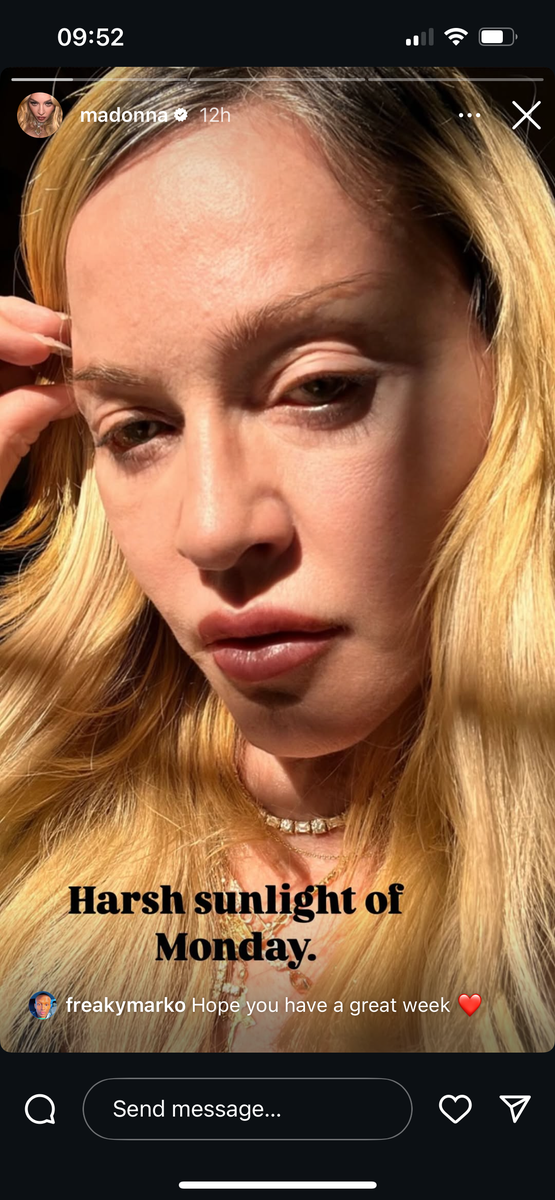 Madonna goes makeup-free, revealing her natural skin texture