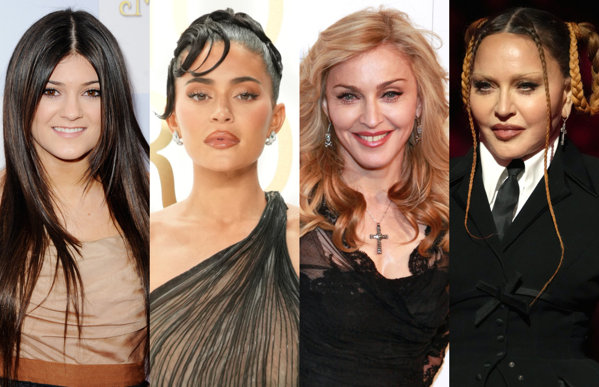 Prima e dopo: celebrità stravolte dalla chirurgia estetica