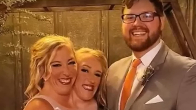 What Life Is Really Like For Conjoined Twins Abby And Brittany Hensel Today