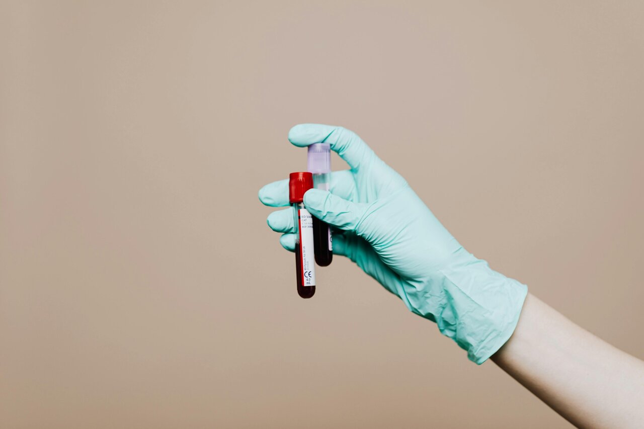 Blood, urine and other bodily fluids: How your leftover pathology ...