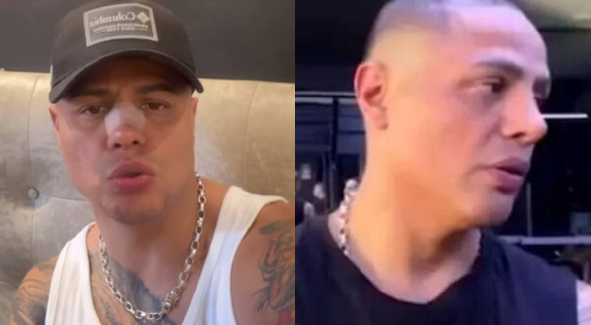 Jonathan Maicelo responde fuertemente a las críticas por su NUEVA nariz ...