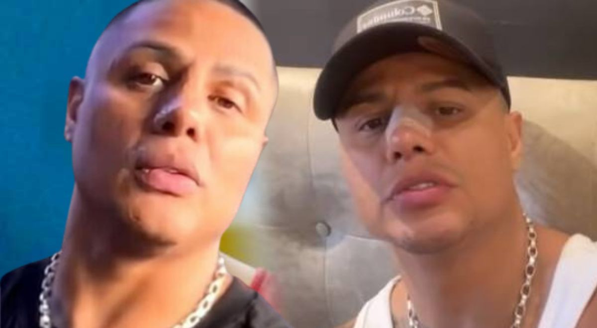 Jonathan Maicelo se pronuncia tras críticas a su operación de la nariz ...