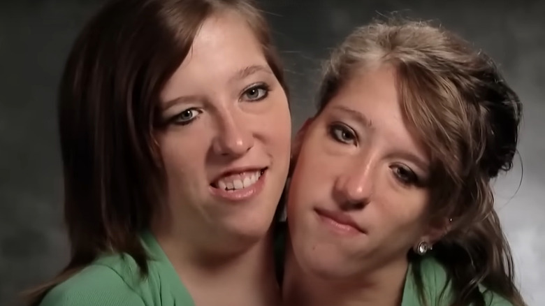 What Life Is Really Like For Conjoined Twins Abby And Brittany Hensel Today