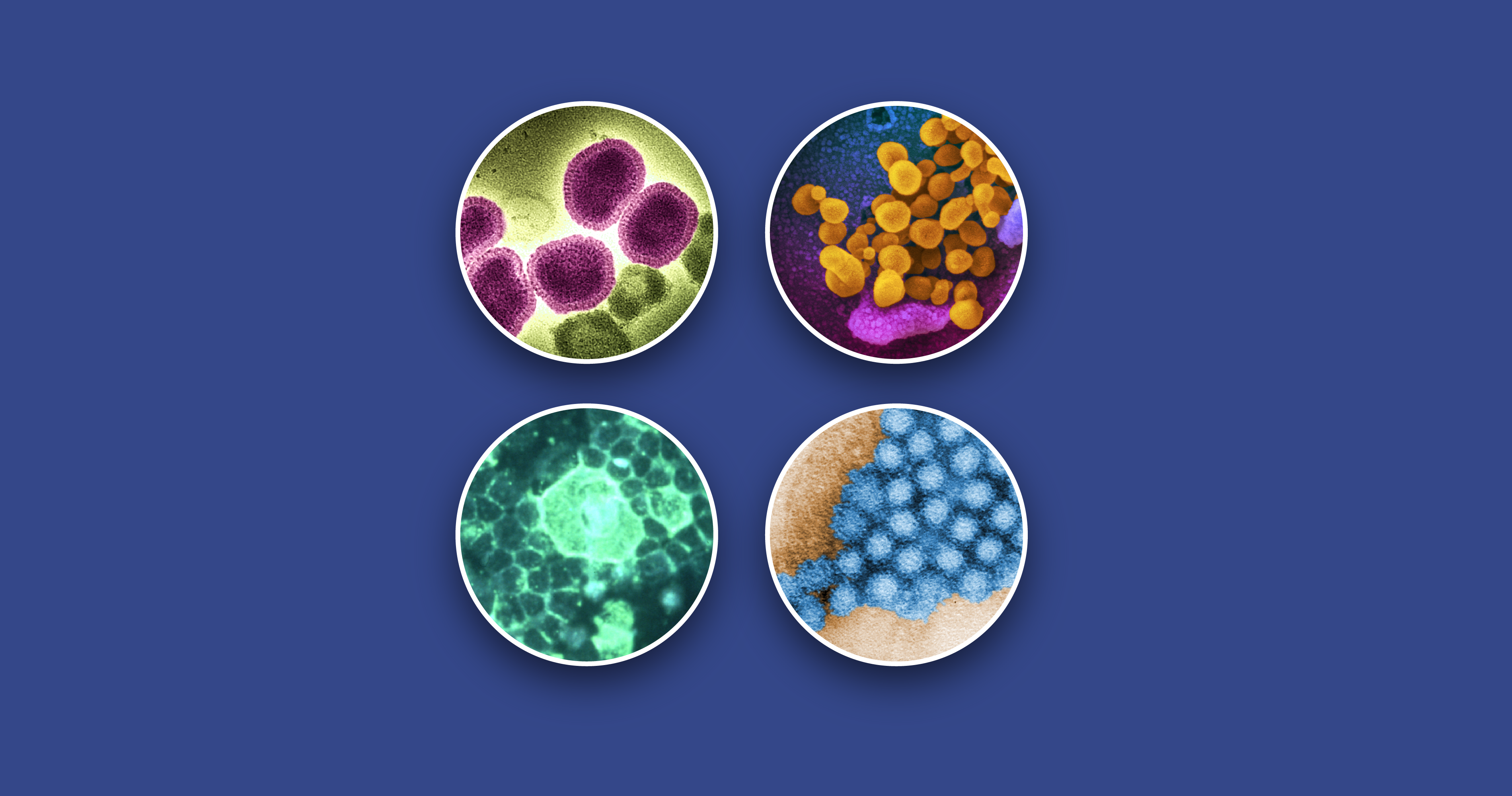 How long is the flu contagious? What to know as cases rise