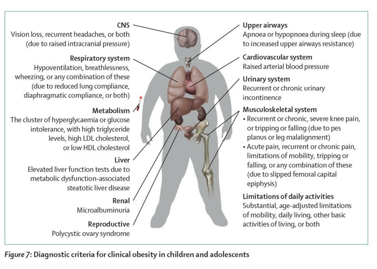 We’re measuring obesity wrong — experts pinpoint 3 signs you may fit ...