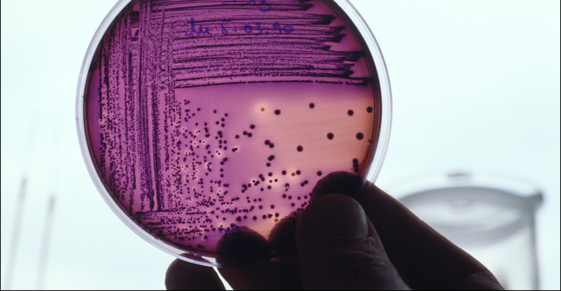 The harmful bacteria that can exist in the human body