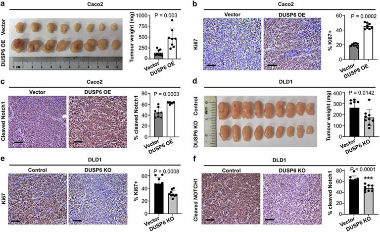 Colorectal cancer treatment: New therapy could be achieved by blocking ...