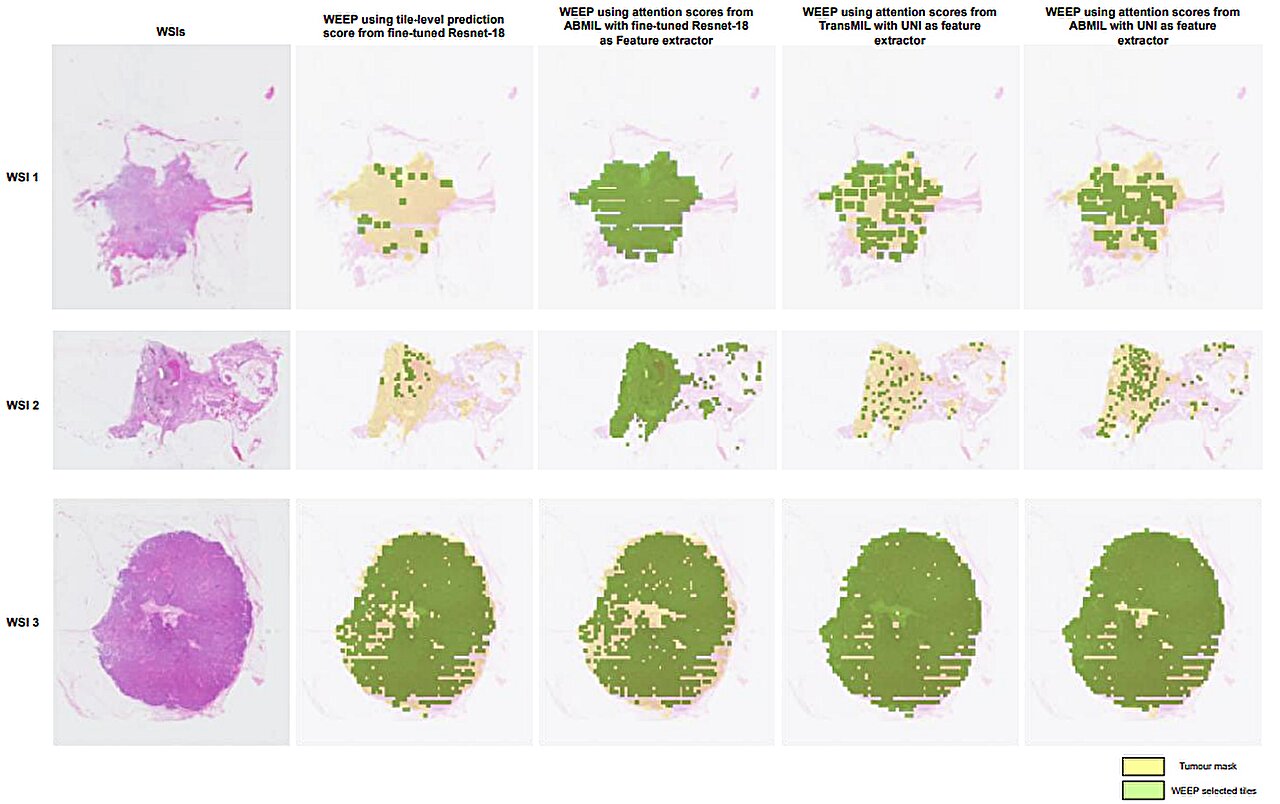 Exploring novel deep learning-based models for cancer histopathology ...