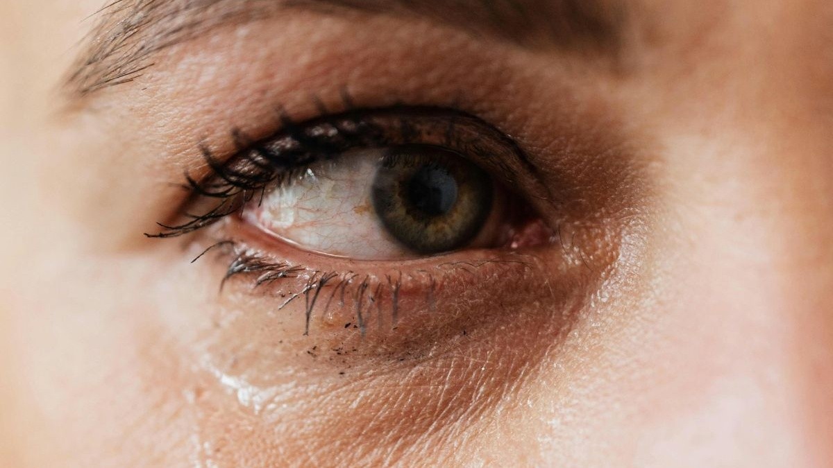Why is My Eye Crying and Itching?