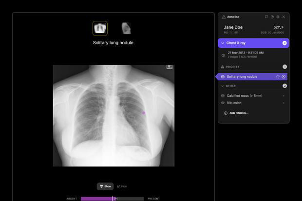 Bradford and Airedale hospitals to use AI to analyse chest X-rays