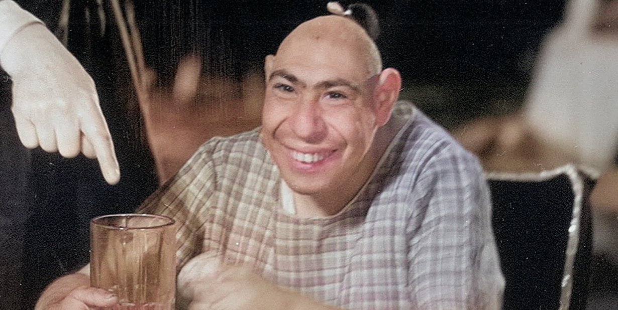 The Heartbreaking Story Of Schlitzie The Pinhead