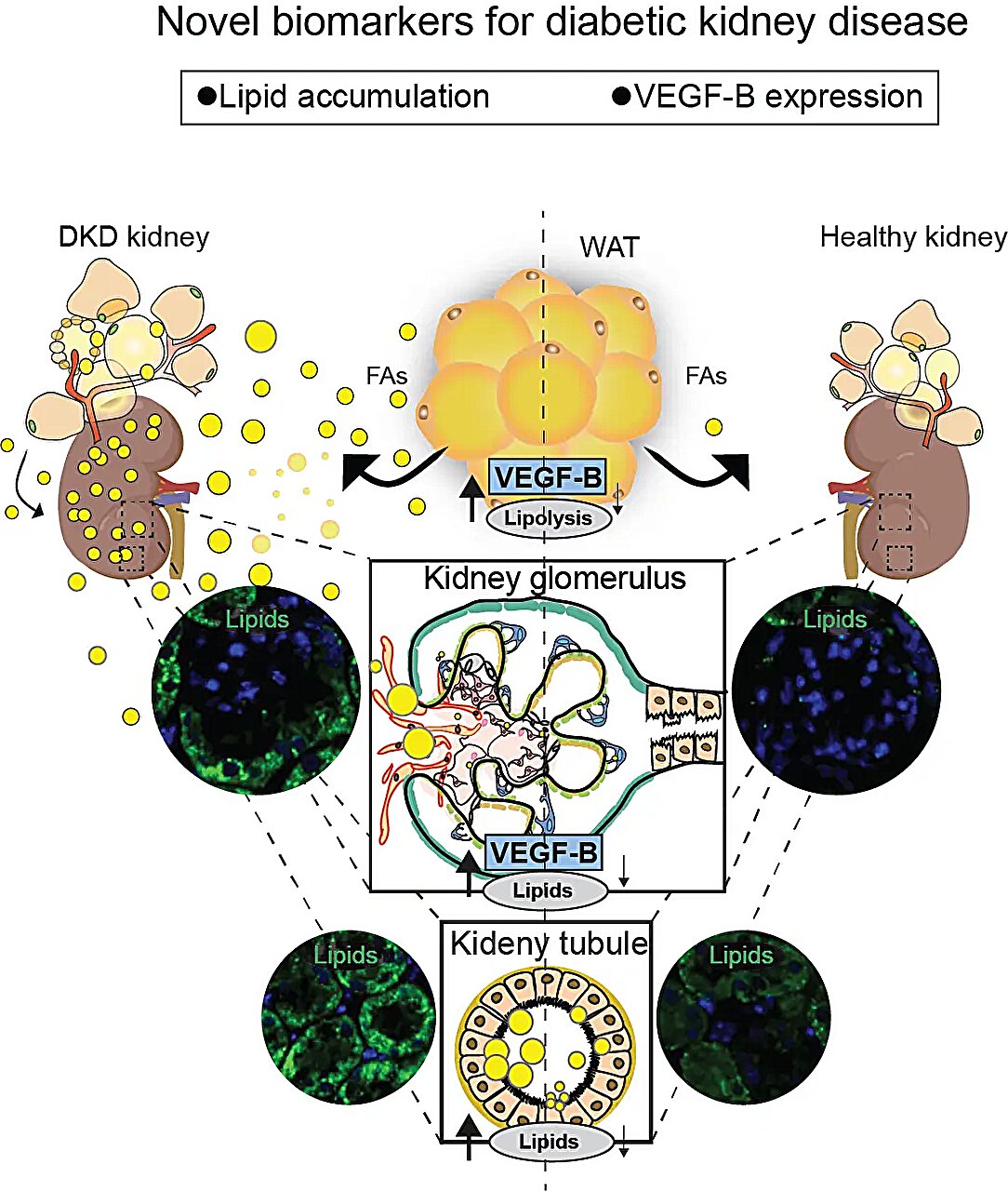Researchers find association between elevated levels of protein VEGF-B ...