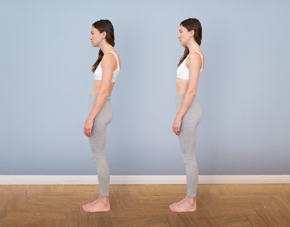4 Types of Poor Posture and How to Fix Each of Them