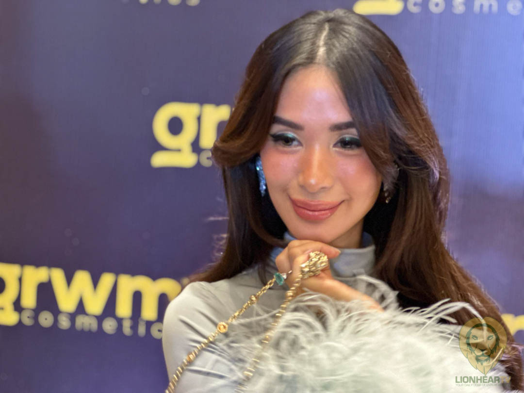 Heart Evangelista laughs off news coverage of tick bite incident