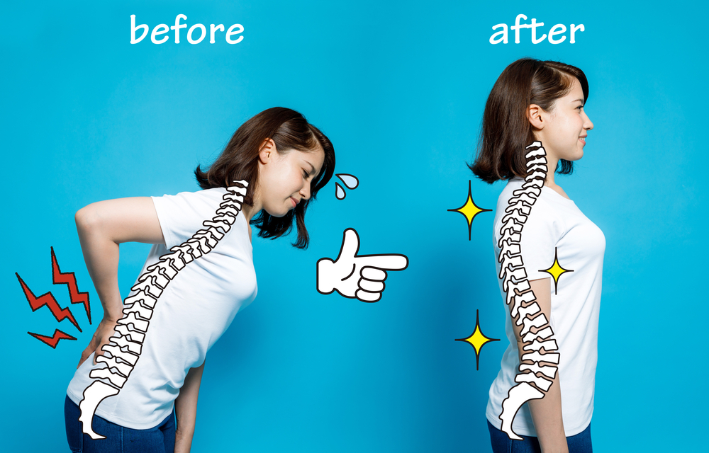 How to Fix the 4 Most Common Posture Problems