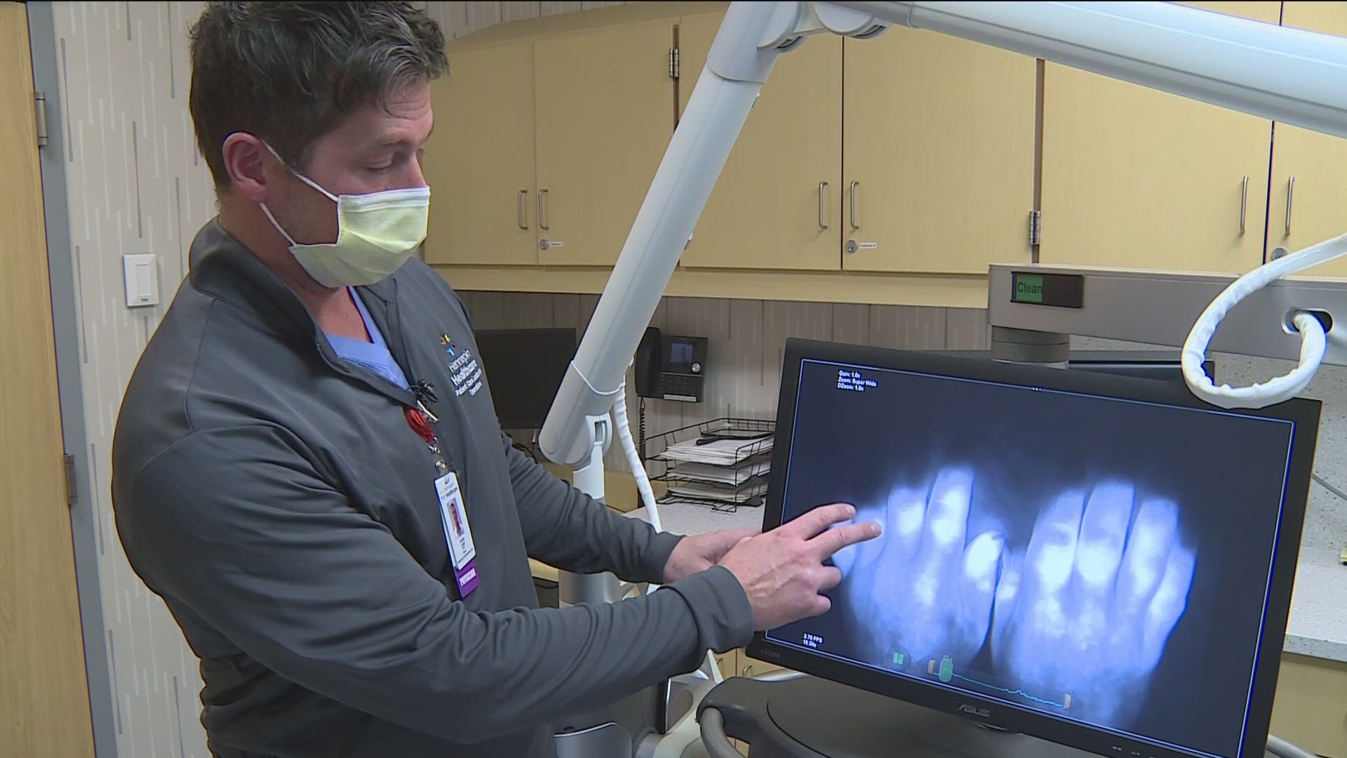 Local doctors prepare to see uptick in frostbite cases during cold snap