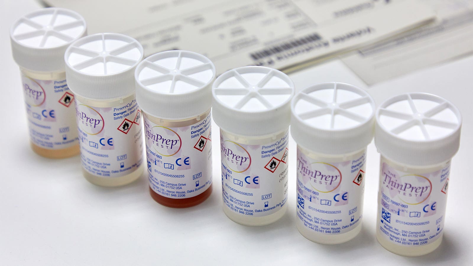 Iffy Follow-Up Care for Many Patients With High-Risk HPV, Study Finds