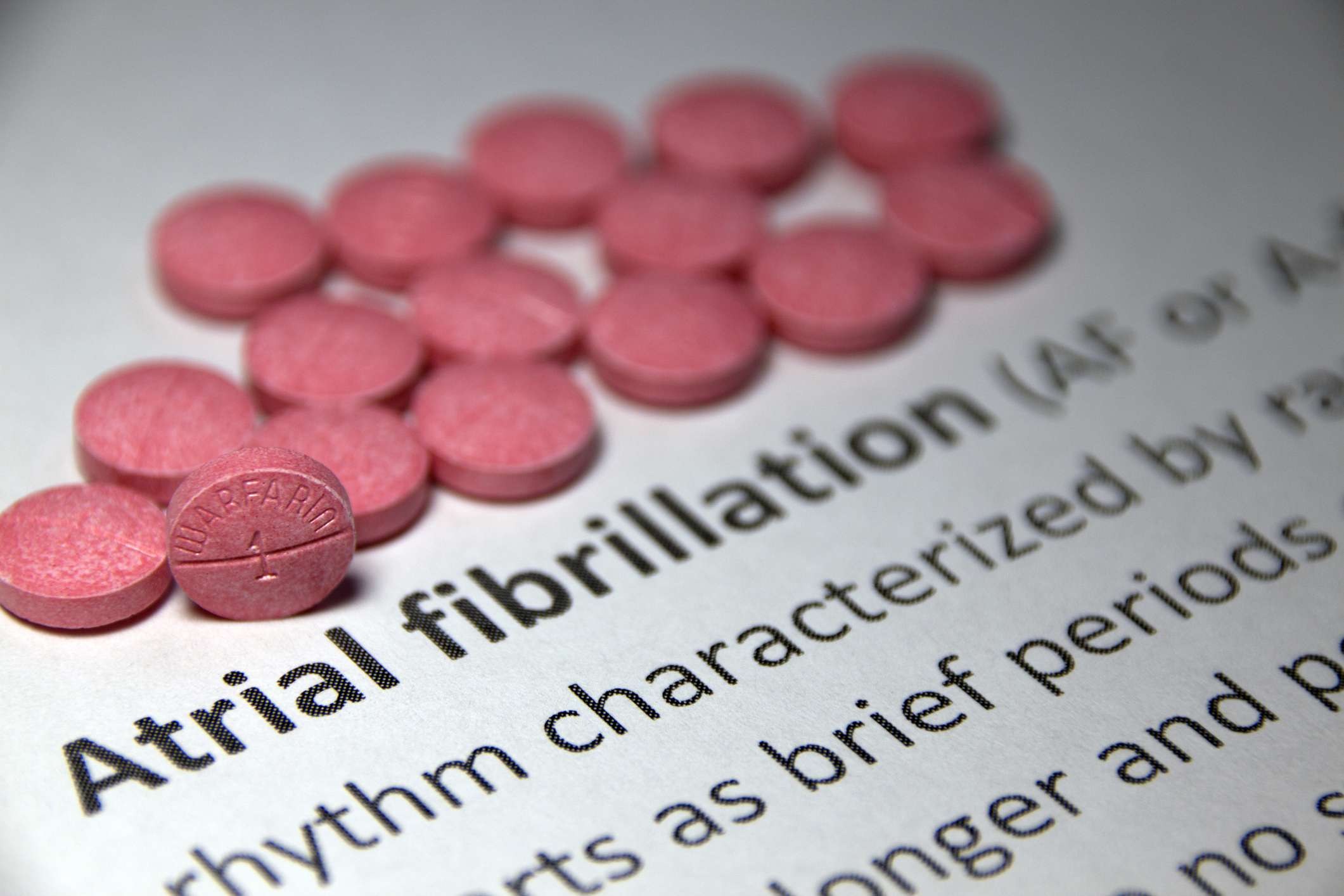 Atrial fibrillation life expectancy