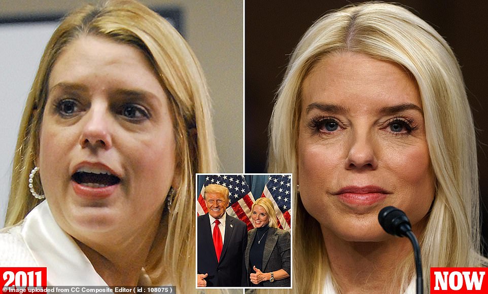 Plastic surgeons weigh in on MAGA Pam Bondi's age-defying look at 59