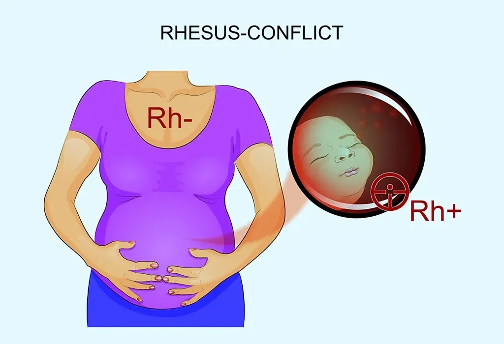 The RH Factor: How it can affect your pregnancy